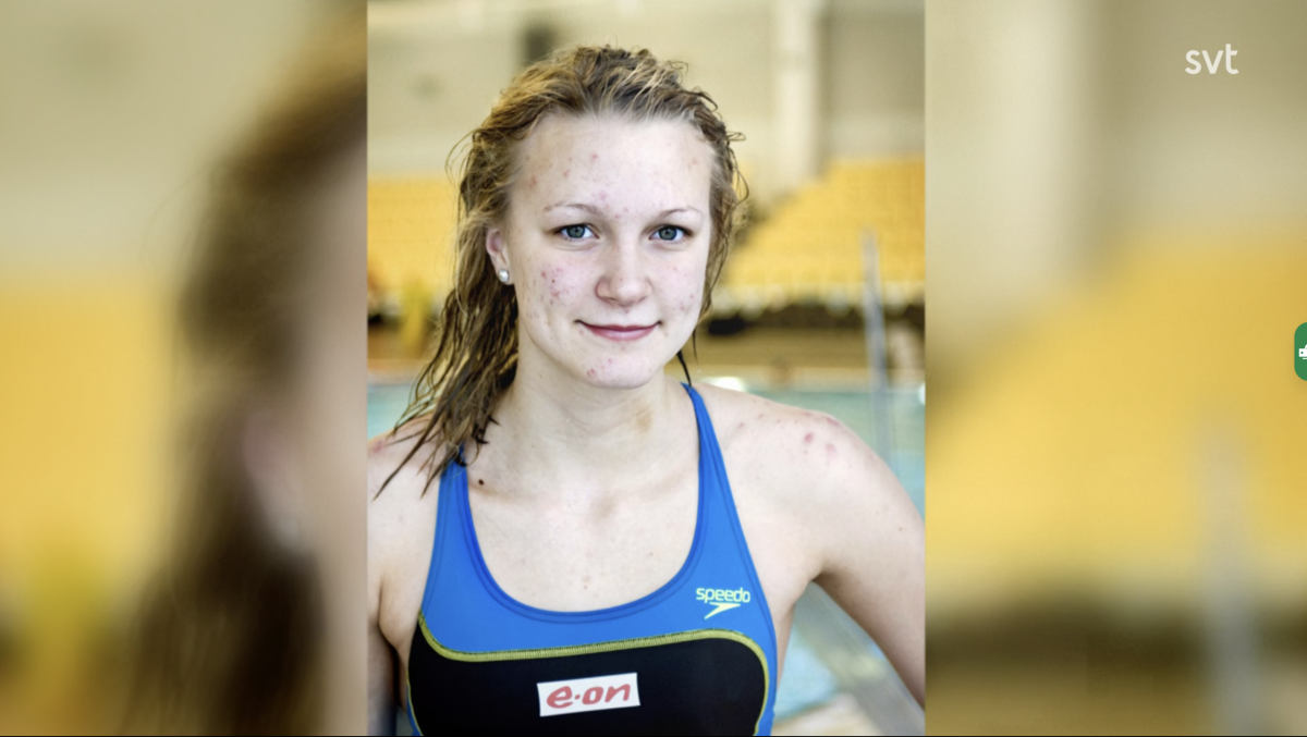 Sarah Sjöström om tonårens hudproblem: ”Det påverkade min simning ...
